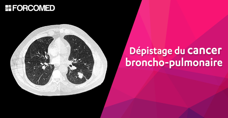 Cancer du poumon Dépistage et bilan TDM - FORCOMED